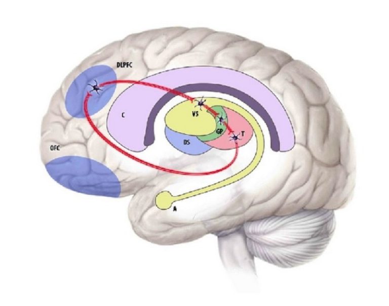 Symptoms of Frontal Lobe Disease - HealthRemedy123 | Easy Health & Remedy