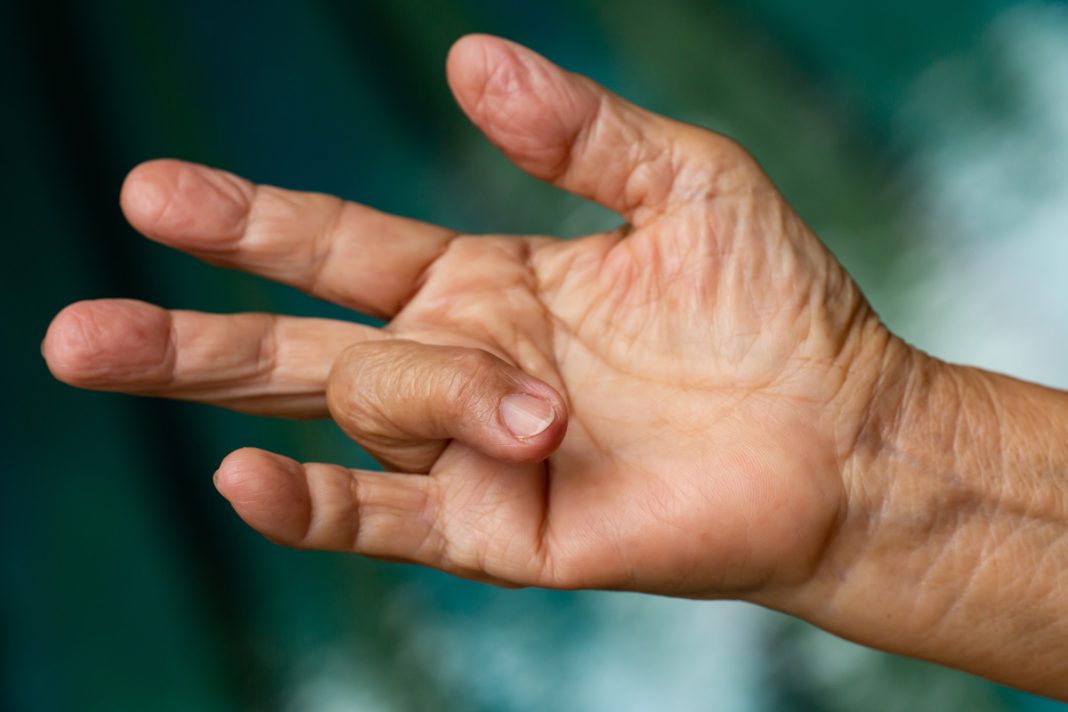 What Are the Causes of Clicking Finger Joints? - HealthRemedy123 | Easy ...